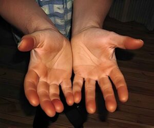How to Clean Stains from Hands » Remove Any Stains
